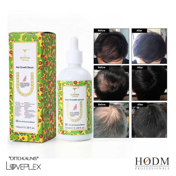 Hair Growth Serum YELLOW FIFTEEN U series - ottokaunis Loveplex
